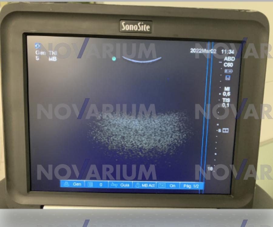 Sonosite P15637 - LCD Screen - Novarium